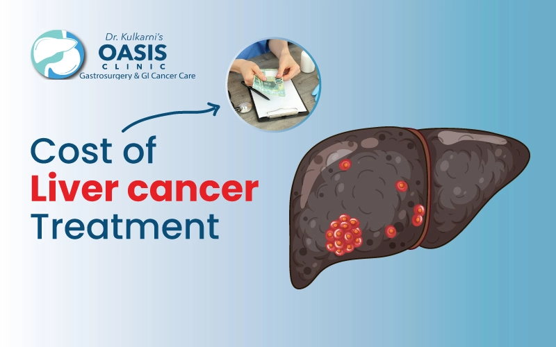 What is the Cost of Liver Cancer Treatment | Dr. Aditya Kulkarni
