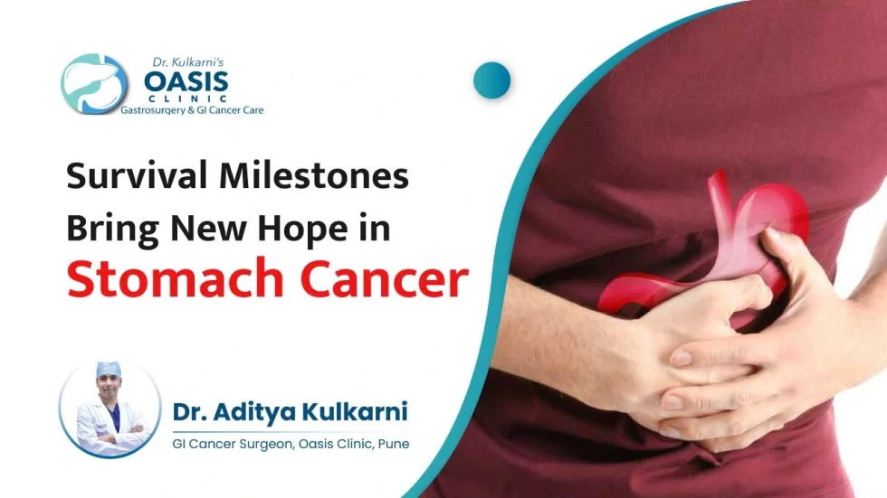 Stomach Cancer Do You Know The Signs Of Stomach Cancer? 🤔 Stomach