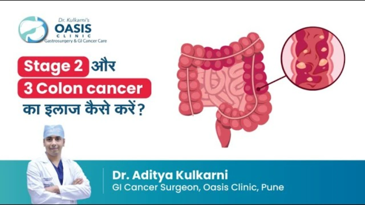How to Treat Stage 2 and 3 Colon Cancer