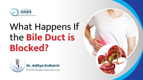 Blocked Bile Duct: Causes and Effects Explained